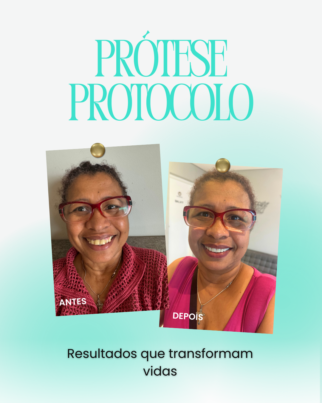 Prótese Protocolo na Zona Sul SP | Soluciona Odontologia